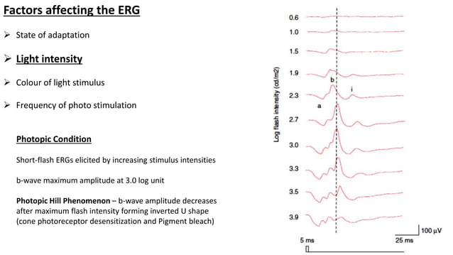 Electroretinogram and Clinical Applications | PPTX | Eye and Vision ...