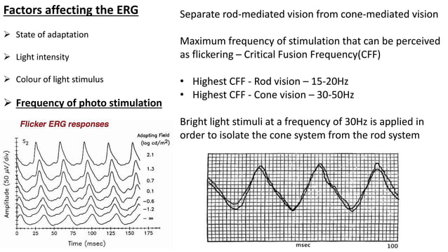 Electroretinogram and Clinical Applications | PPTX | Eye and Vision ...