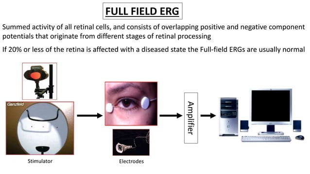Electroretinogram and Clinical Applications | PPTX | Eye and Vision ...