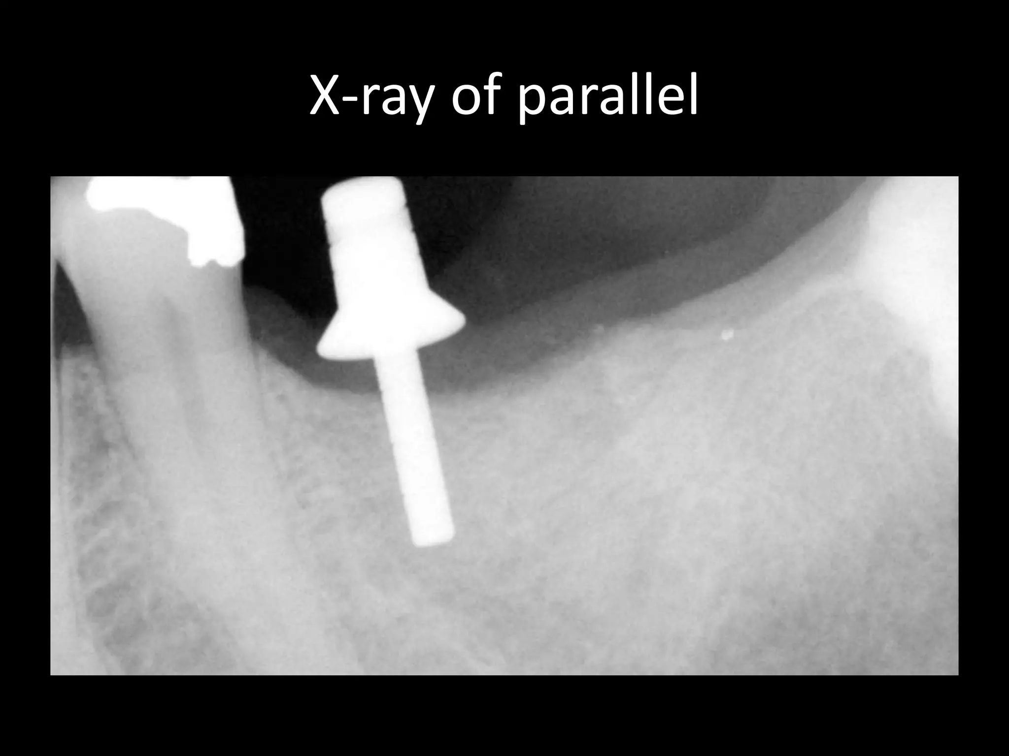 OCO Biomedical ERI Case | PPTX