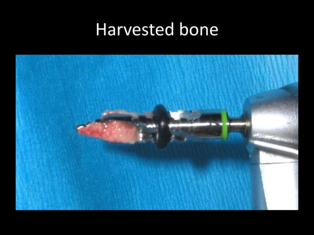 OCO Biomedical ERI Case | PPTX