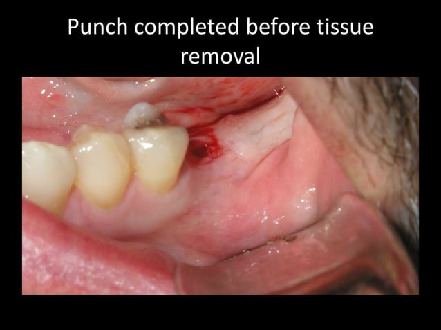 OCO Biomedical ERI Case | PPTX