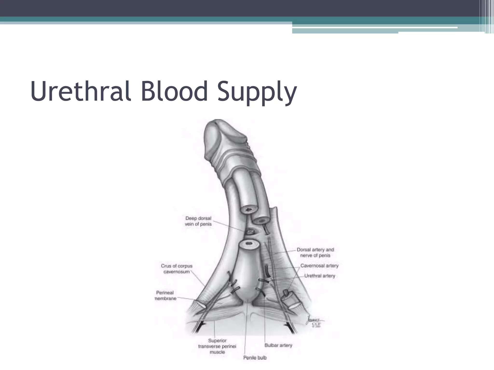 urethroplasty | PPTX