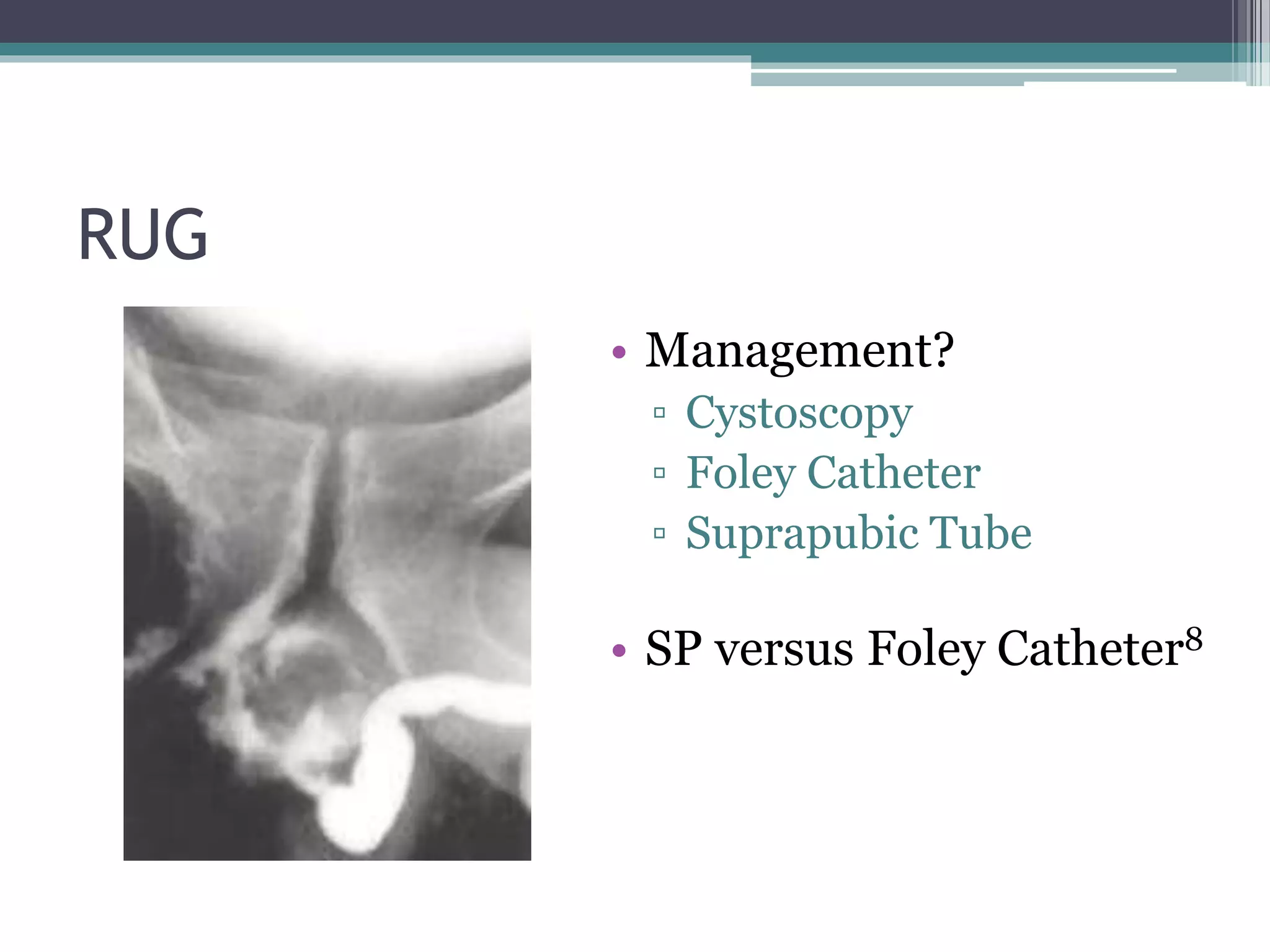 urethroplasty | PPTX