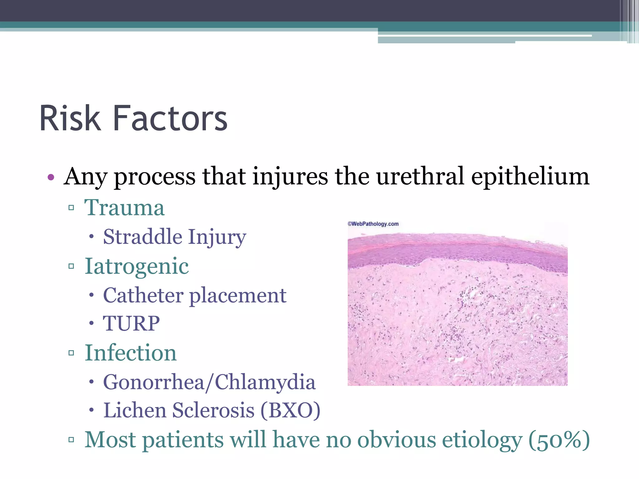 urethroplasty | PPTX