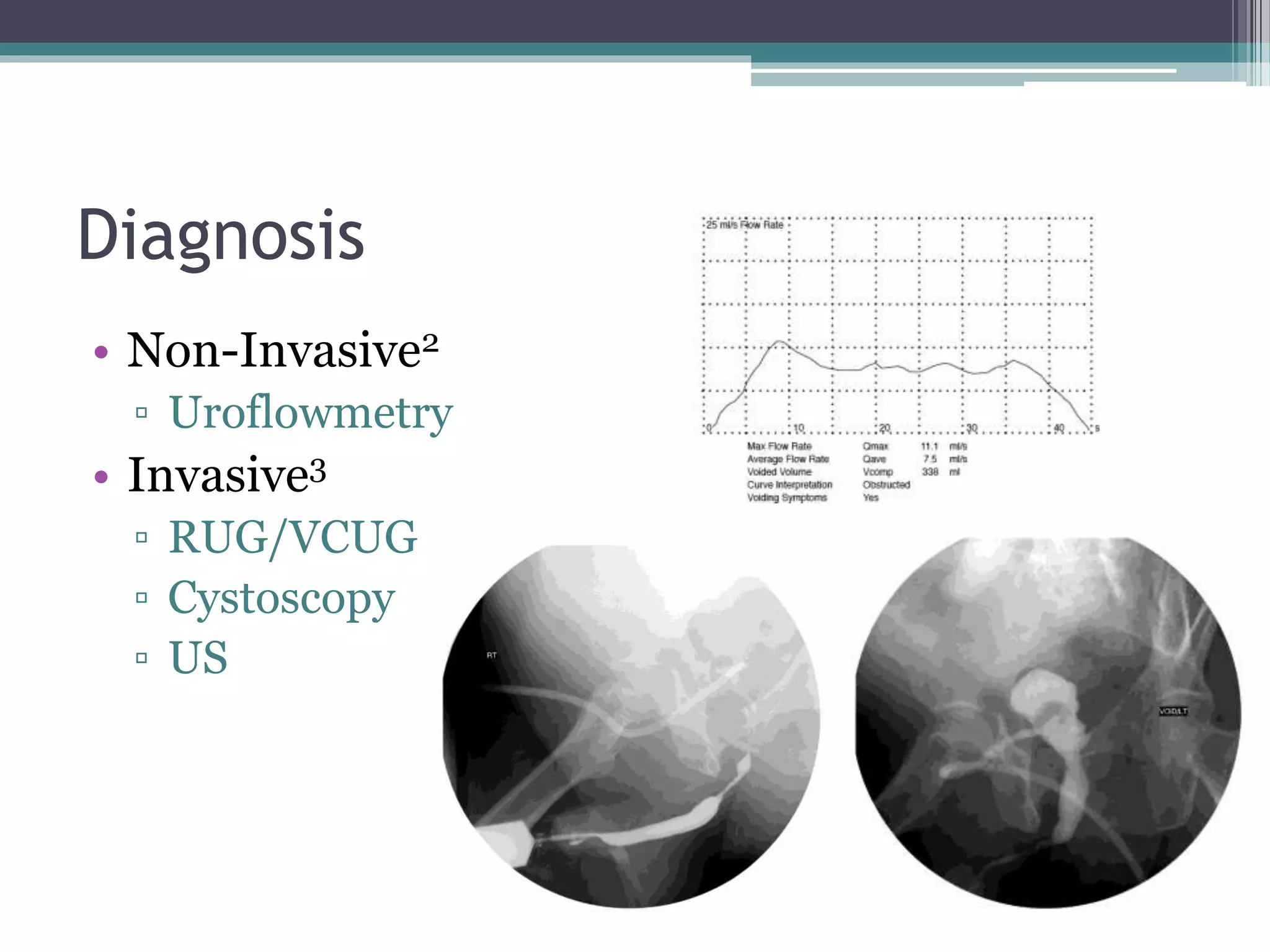 urethroplasty | PPTX