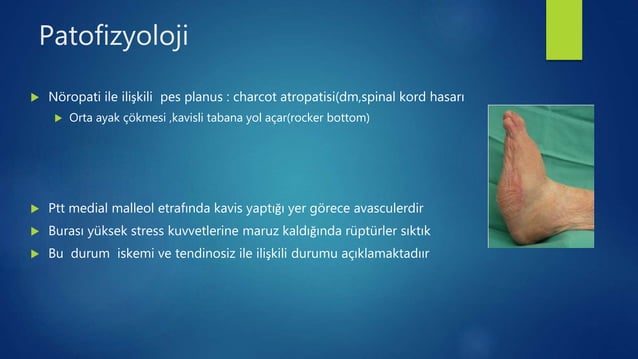 Eri̇şki̇n edi̇ni̇lmi̇ş düz taban deformi̇tesi̇ | PPT