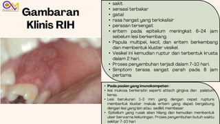 Eris Nurul Rahmadhini - 160721220004 - Recurrent Intraoral Herpes ...
