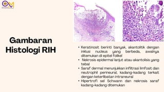 Eris Nurul Rahmadhini - 160721220004 - Recurrent Intraoral Herpes ...