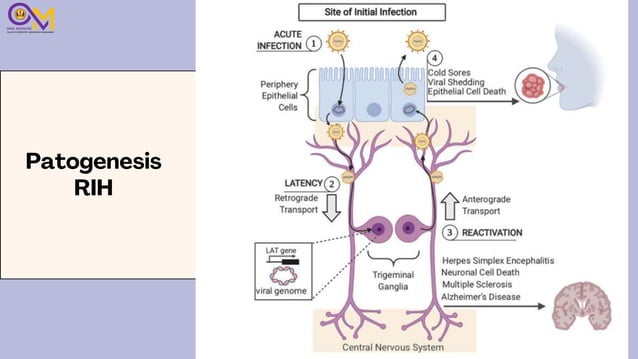 Eris Nurul Rahmadhini - 160721220004 - Recurrent Intraoral Herpes ...