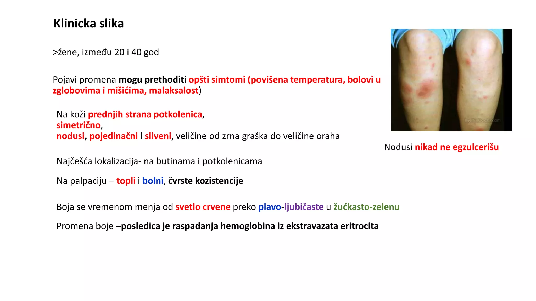 ERITEMA NODOSUM.pptx