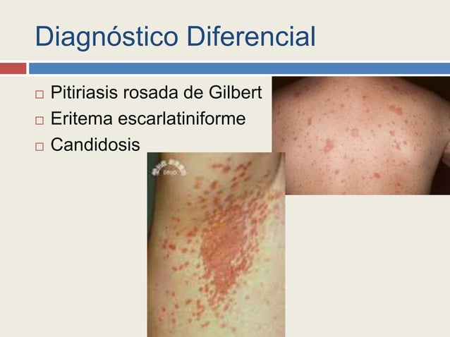 Eritema pigmentado fijo y eritema morbiliforme | PPTX