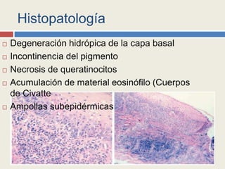 Eritema pigmentado fijo y eritema morbiliforme | PPTX