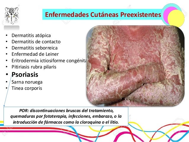 Eritrodermias.slide share
