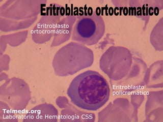 Eritropoyesis Ppt