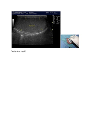 Erkek genital ultrasonografi | DOCX