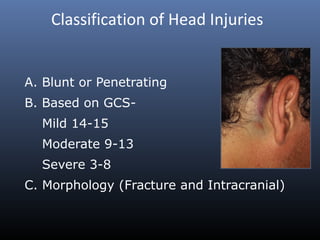 Er management of neurotrauma | PPT