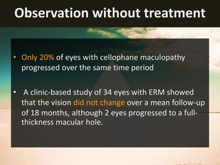 Epiretinal membrane and vitreomacula traction in updates by Panit ...