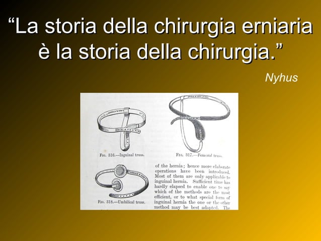 Cos'è un'ernia inguinale? Storia ed attualità della terapia chirurgica ...