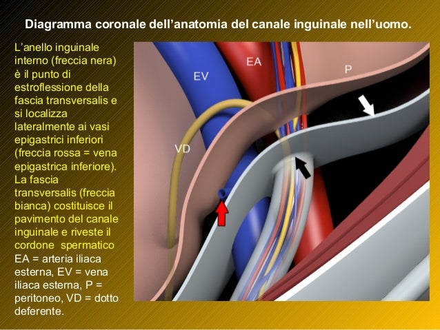 Cos'è un'ernia inguinale? Storia ed attualità della terapia chirurgica