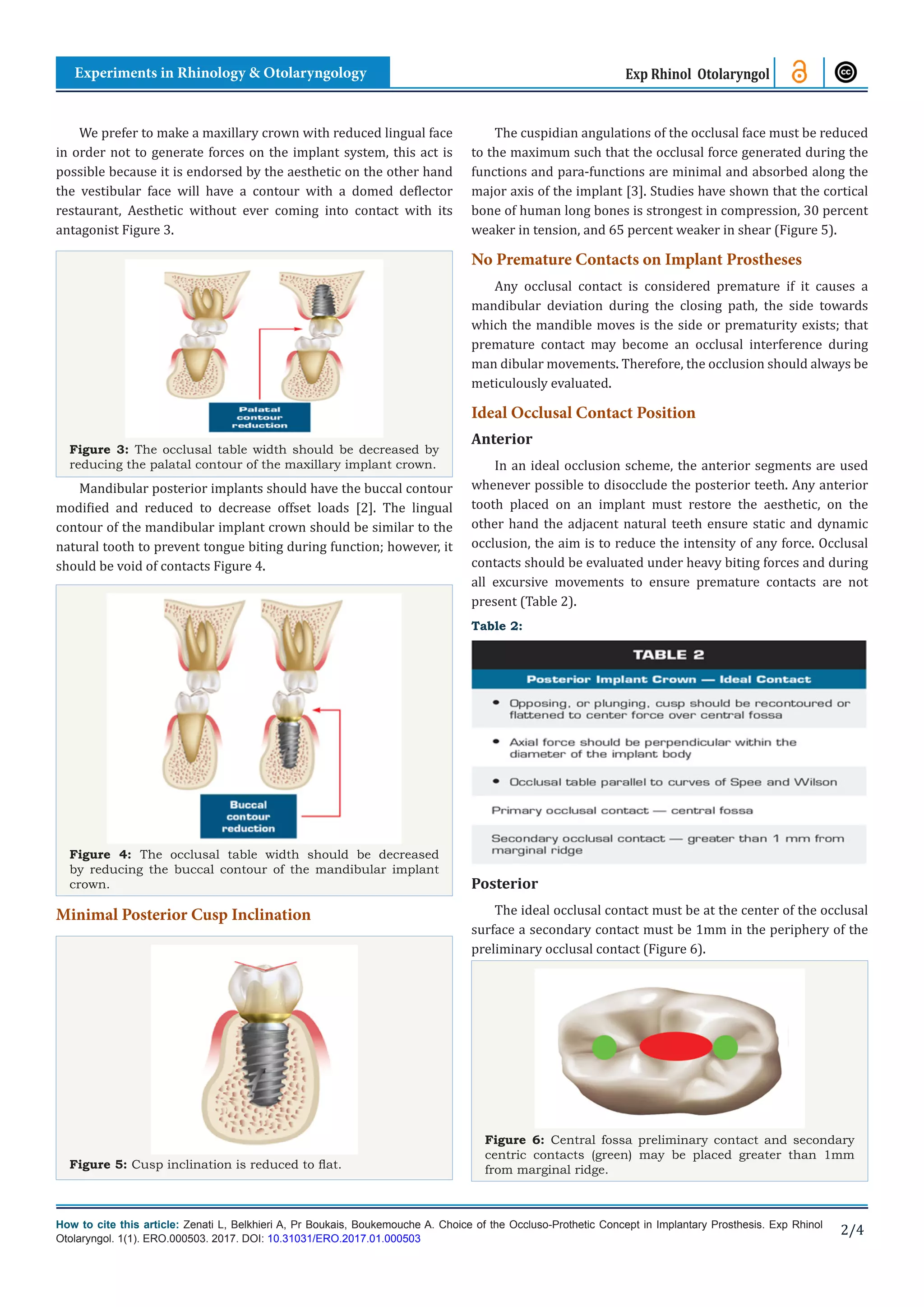 Crimson Publishers-Choice of the Occluso-Prothetic Concept in ...