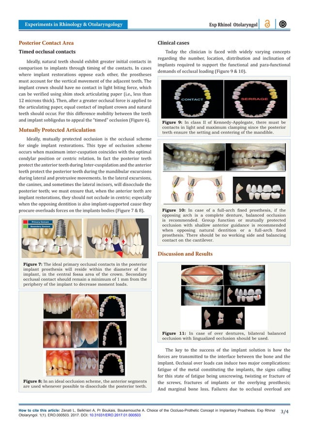 Crimson Publishers-Choice of the Occluso-Prothetic Concept in ...