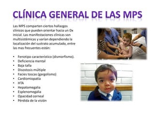 Errores Innatos del Metabolismo de los GAG´s - MUCOPOLISACARIDOSIS | PDF