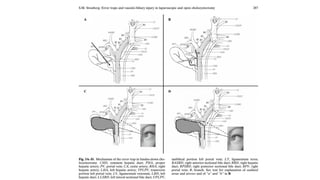 Error TRAPS During lap/open CHOLECYSTECTOMY | PPTX