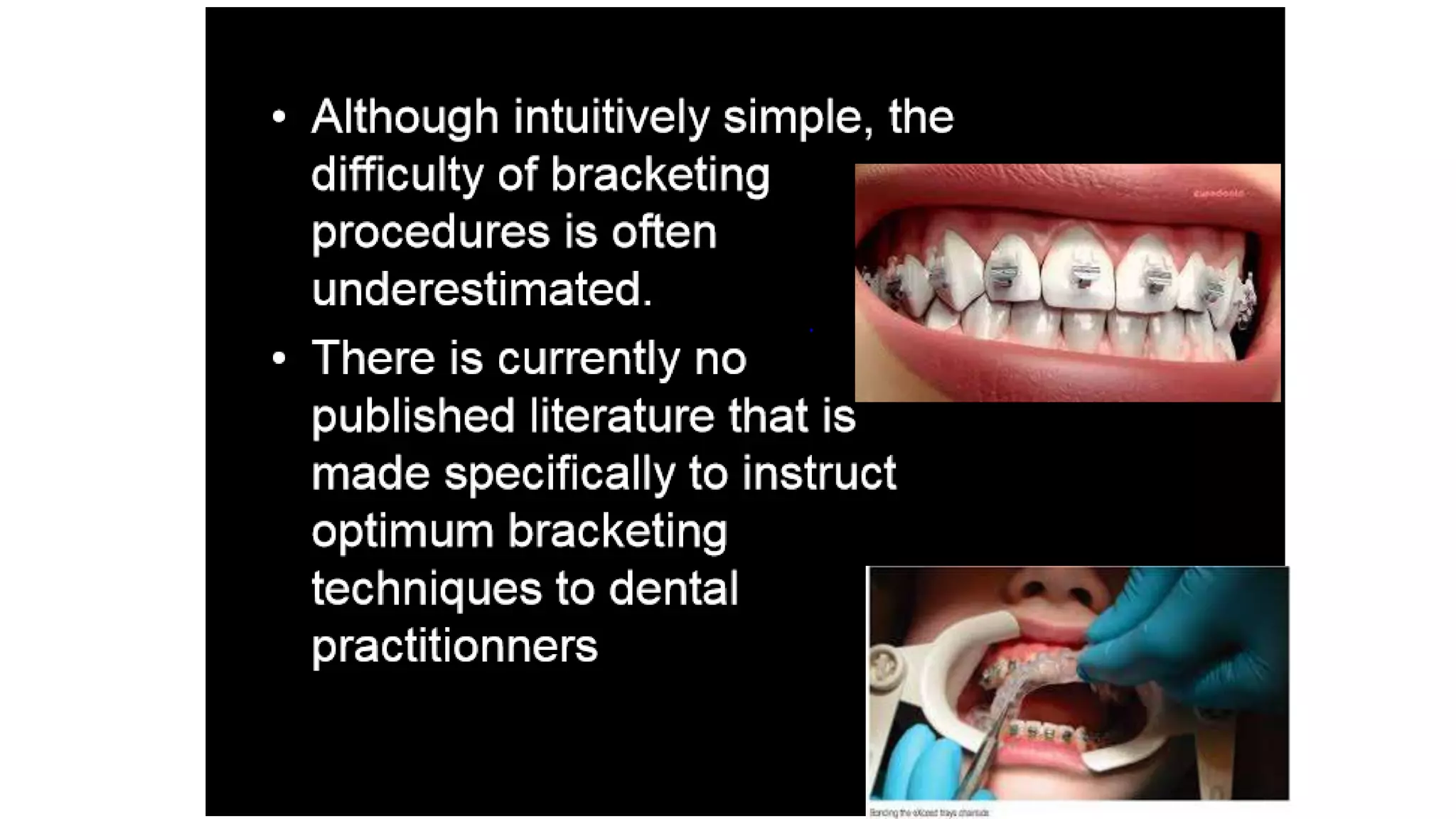 Error in orthodontic bracket placement | PPTX