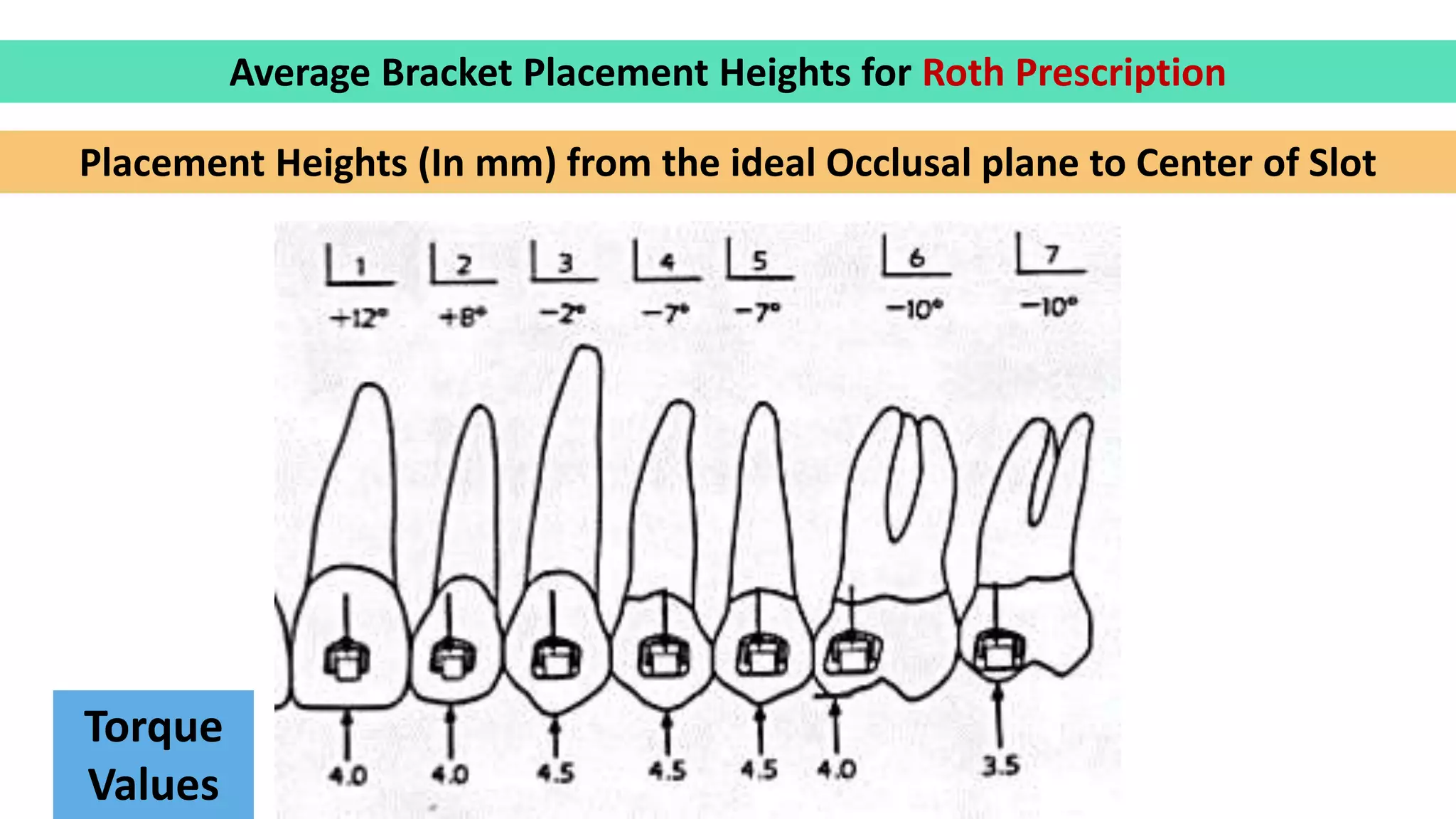 Error in orthodontic bracket placement | PPTX