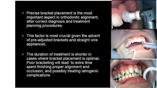 Error in orthodontic bracket placement | PPTX | Dental Health ...