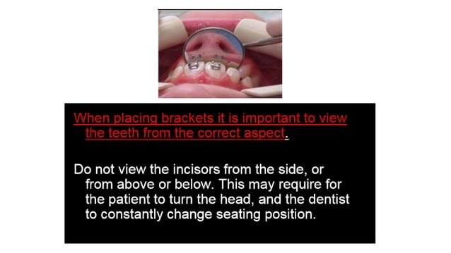 Error in orthodontic bracket placement | PPTX | Dental Health ...