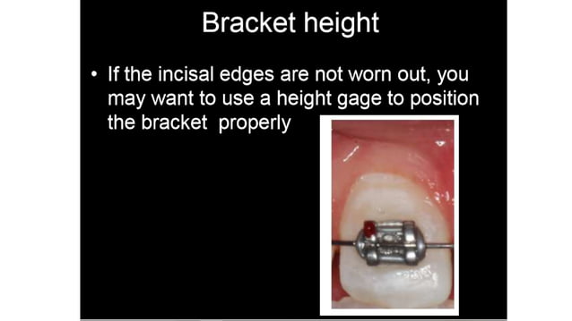 Error in orthodontic bracket placement | PPTX | Dental Health ...