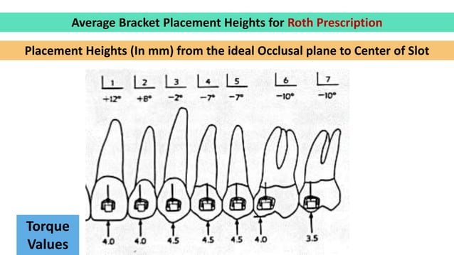 Error in orthodontic bracket placement | PPTX | Dental Health ...