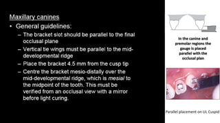 Error in orthodontic bracket placement | PPTX