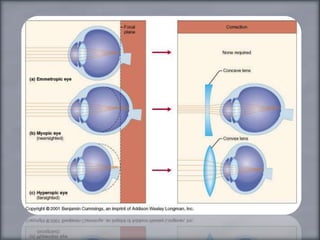 Error of refraction | PPTX