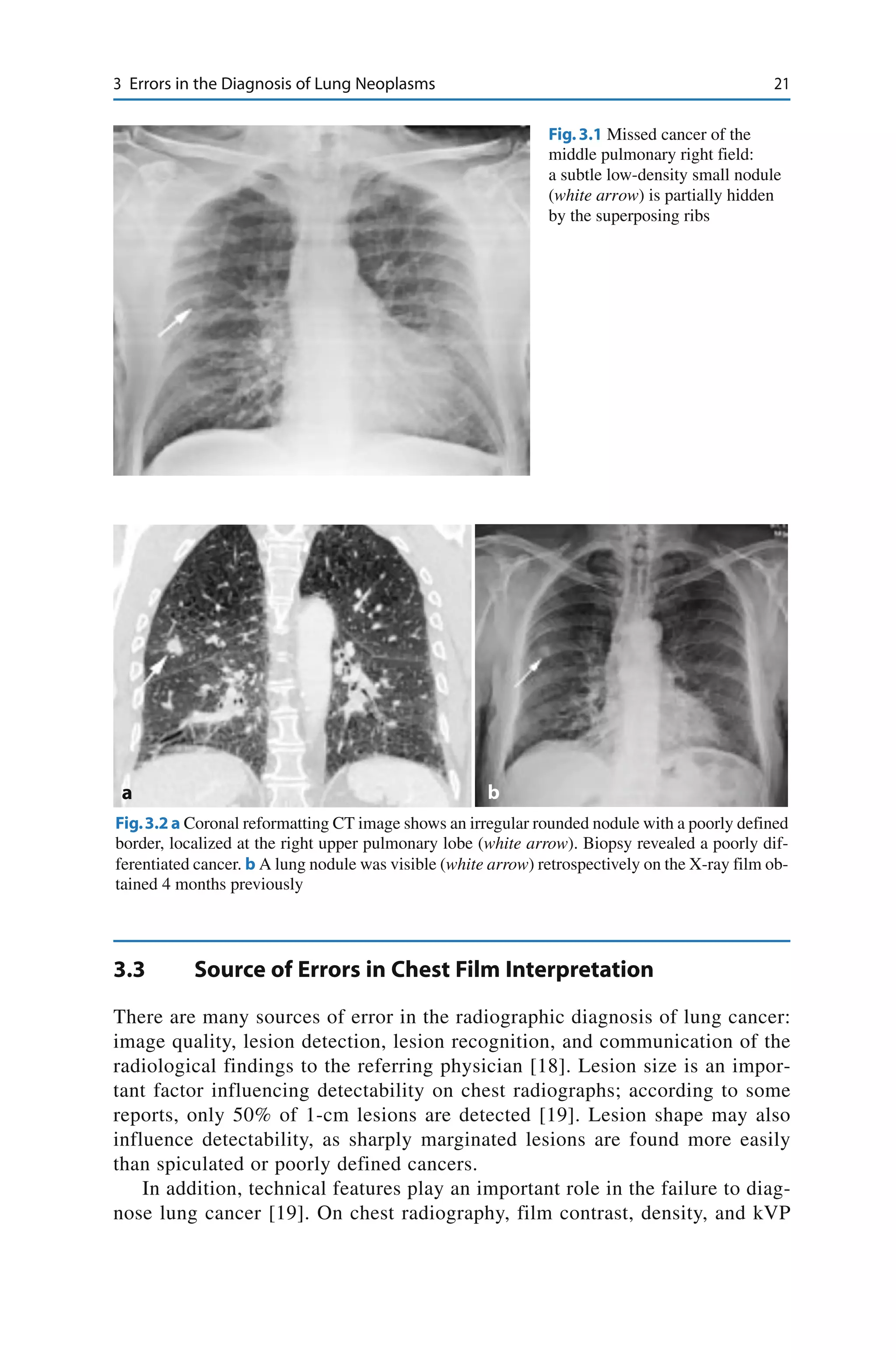 Errors in radiology | PDF
