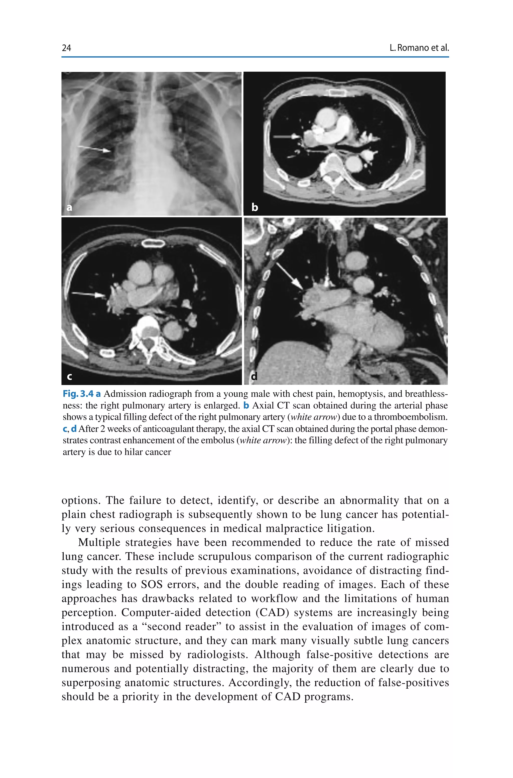 Errors in radiology | PDF