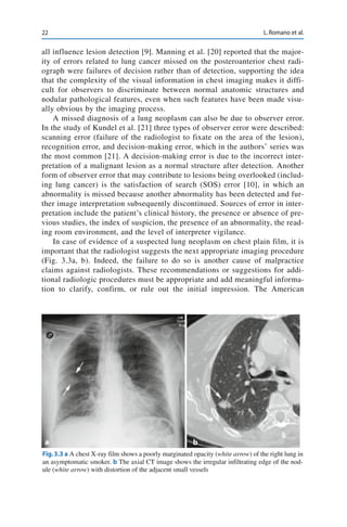 Errors in radiology | PDF