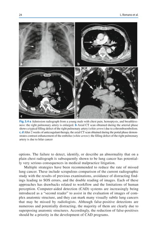 Errors in radiology | PDF