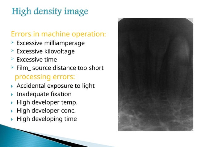 errorsofdentalradiography-161221200448.pptx