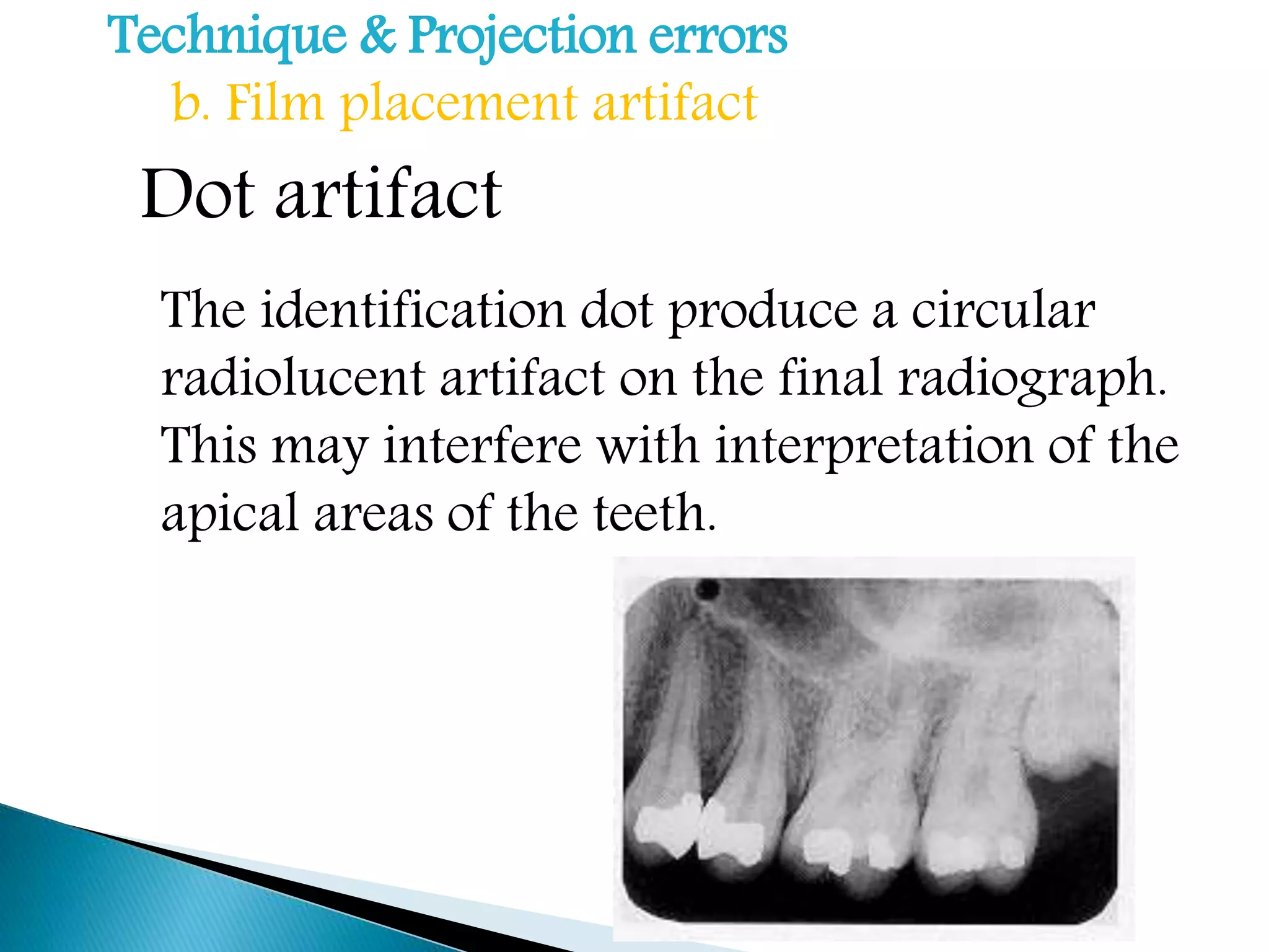 Errors of dental radiography | PPTX