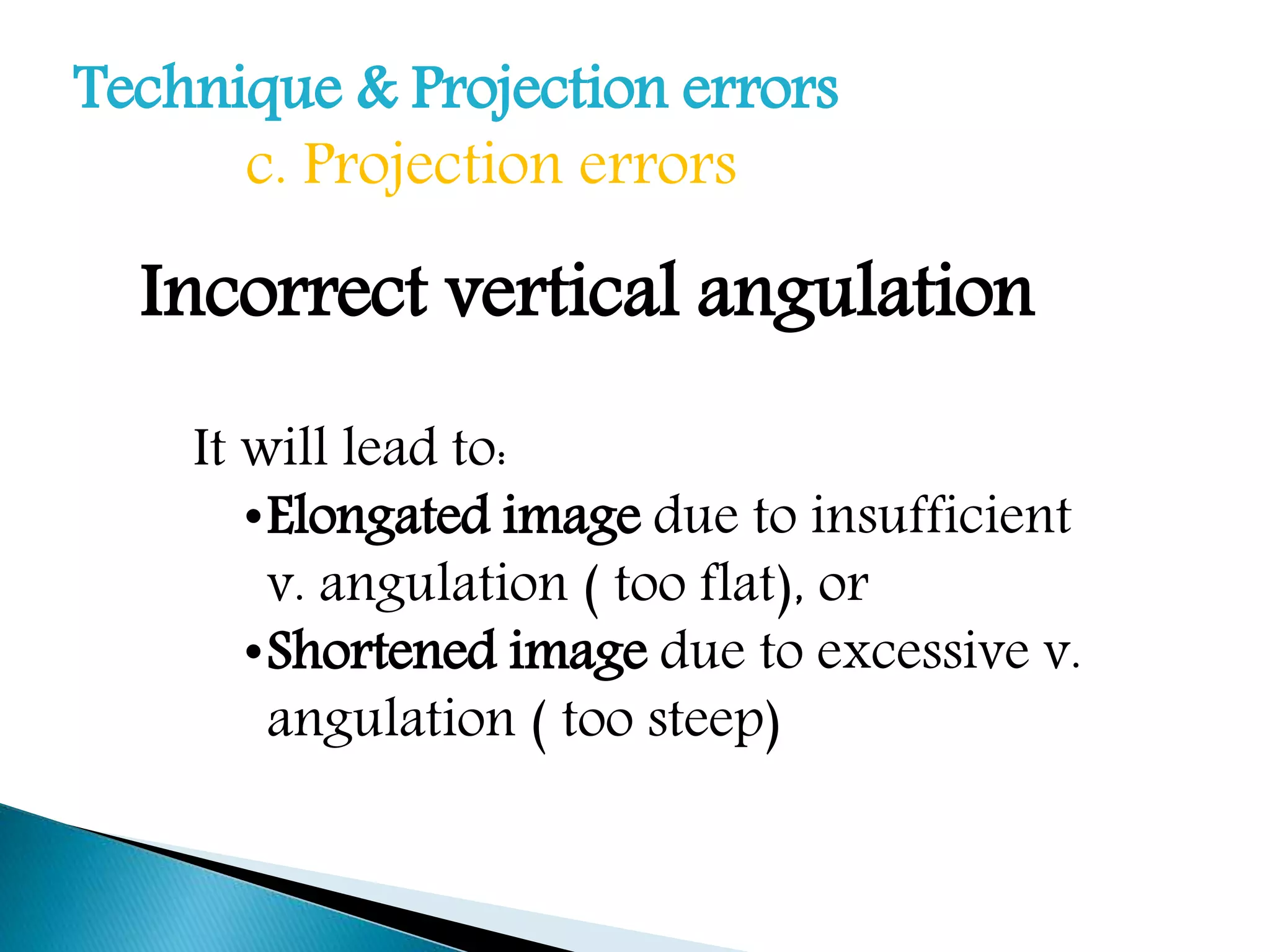 Errors of dental radiography | PPTX