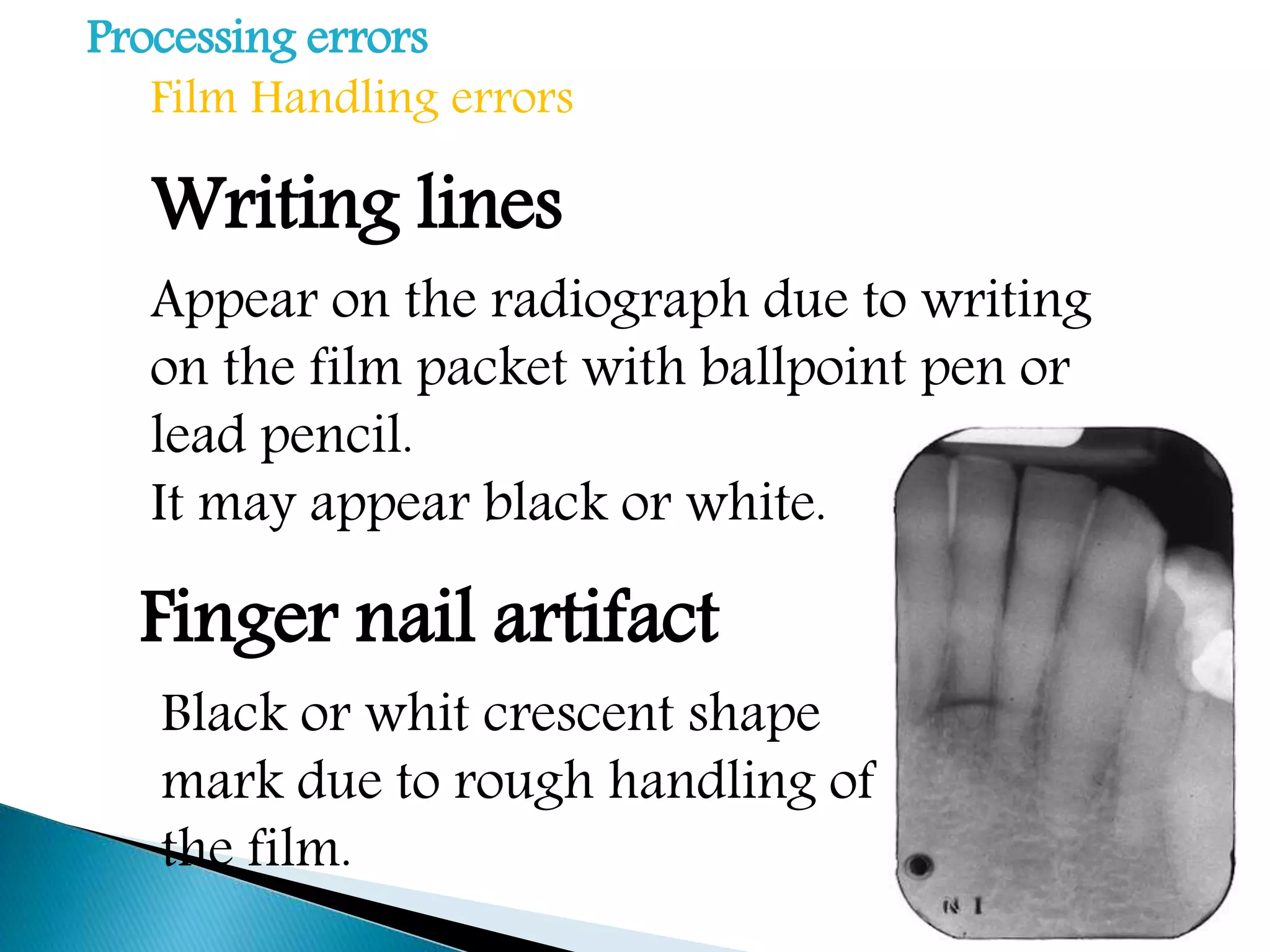 Errors of dental radiography | PPTX
