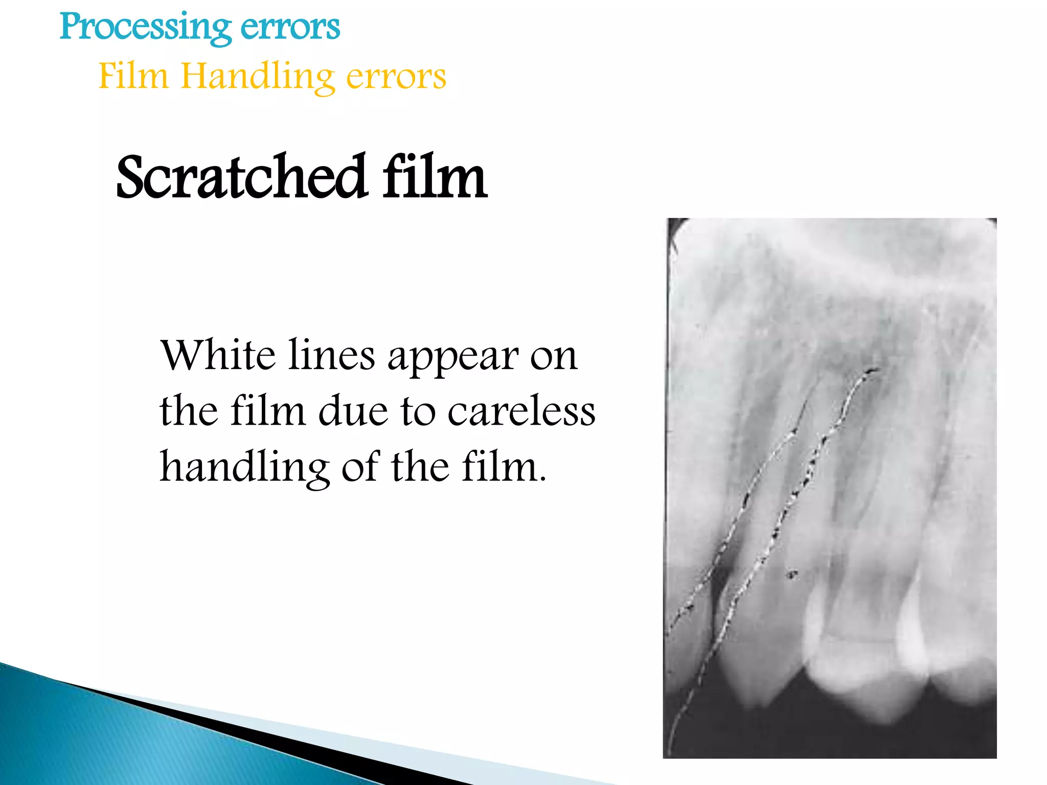 Errors of dental radiography | PPTX