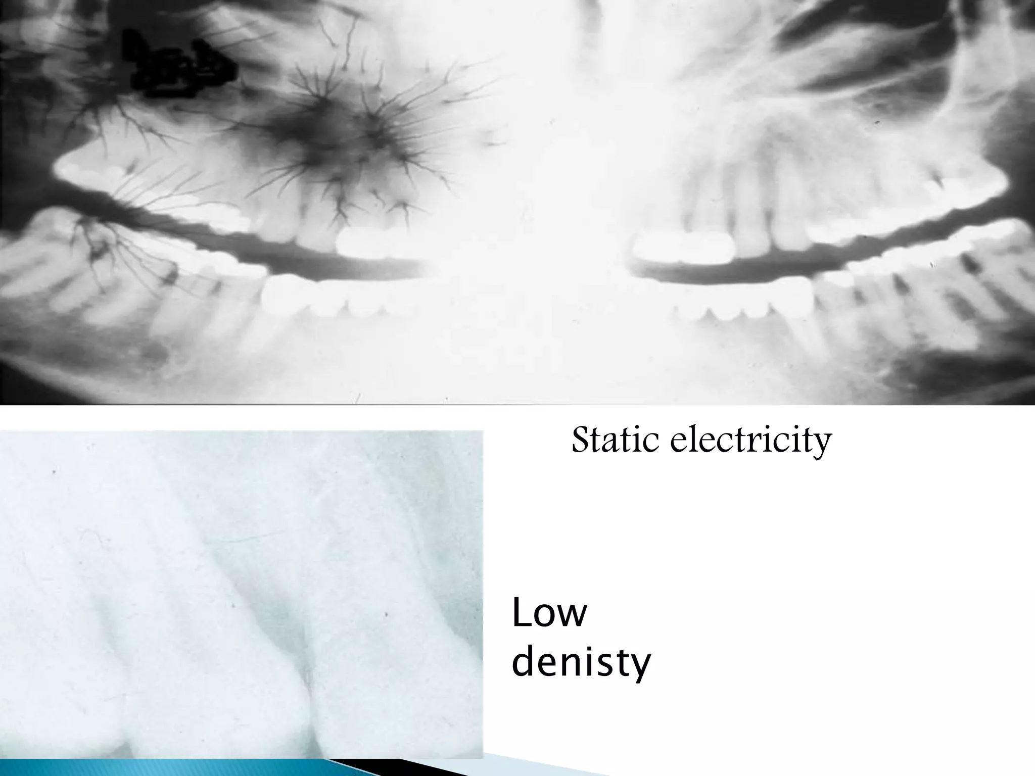 Errors of dental radiography | PPTX