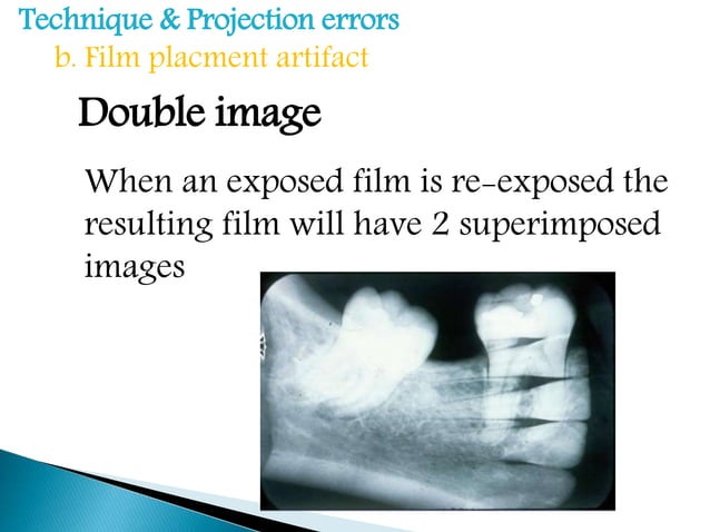 Errors of dental radiography | PPTX