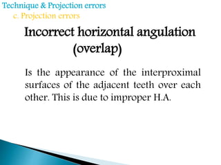 Errors of dental radiography | PPTX