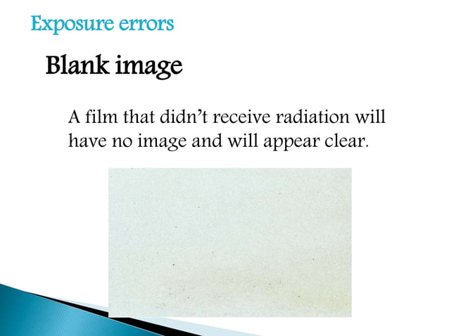 Errors of dental radiography | PPTX