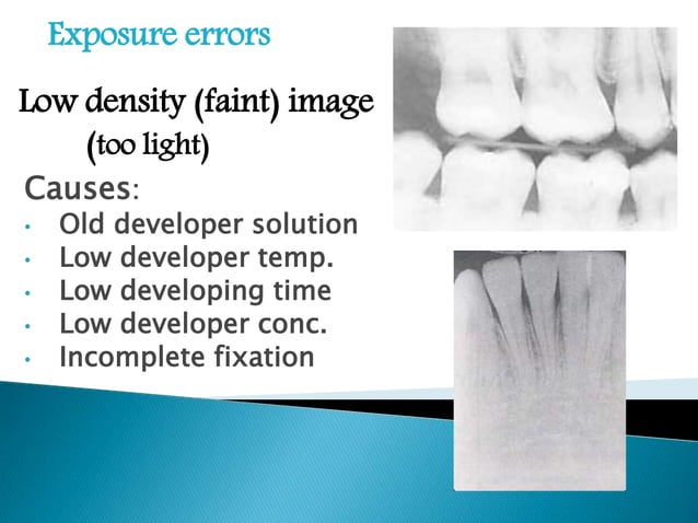 Errors of dental radiography | PPTX
